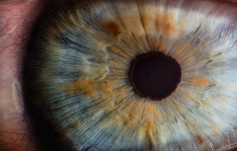 What Causes Cornea Pain? How to Get Your Eye Pain Under Control ...